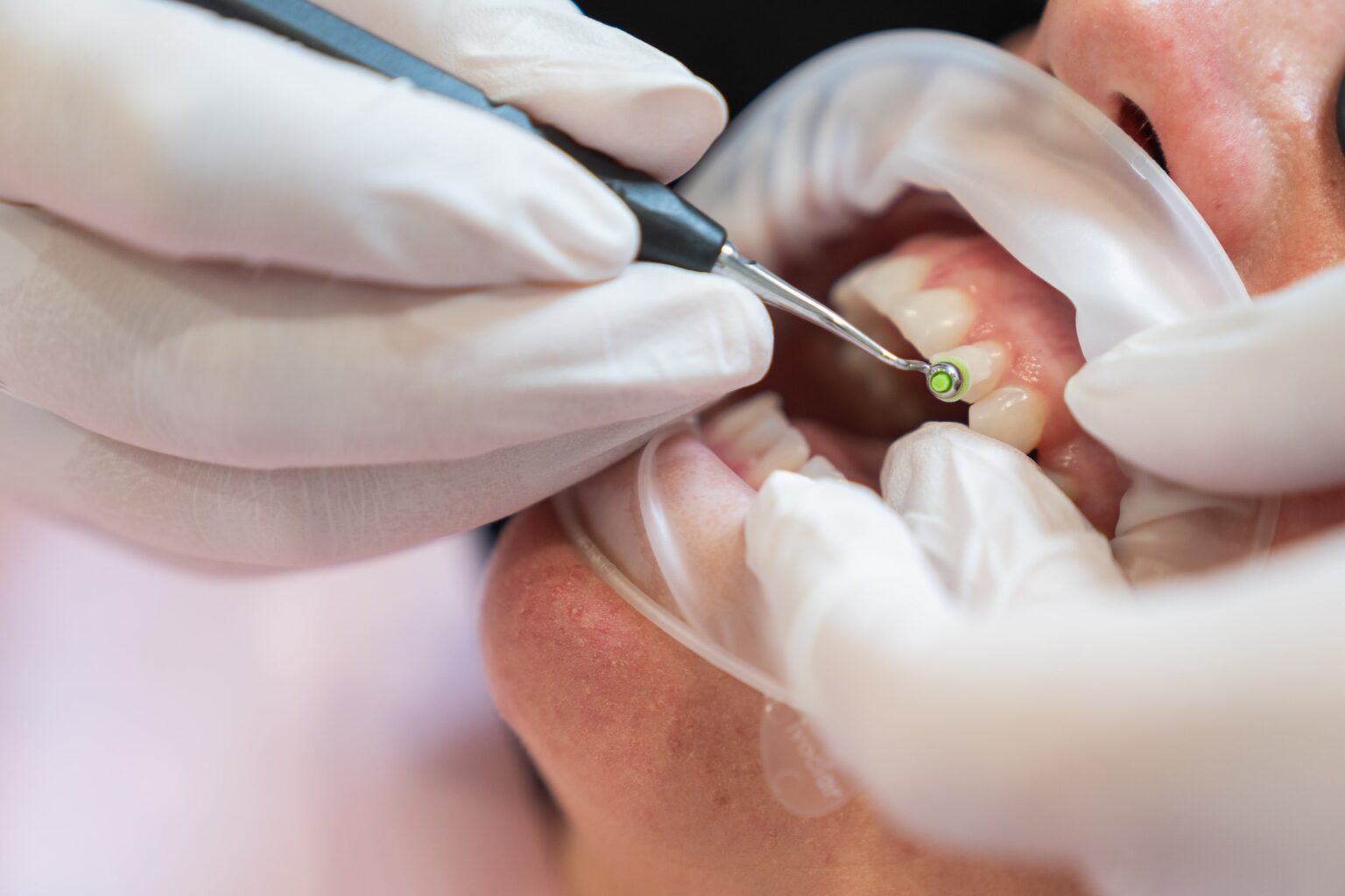 Home - Mint Dental
